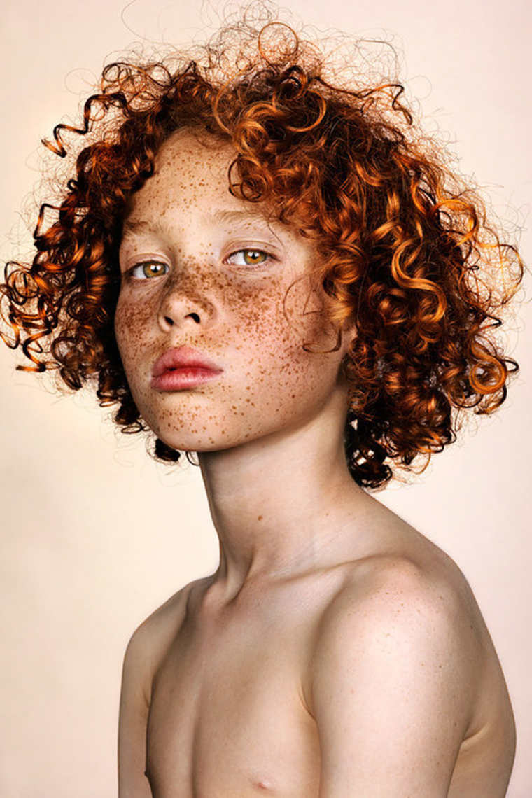 18 Striking Portraits Of Freckled People By British Photographer